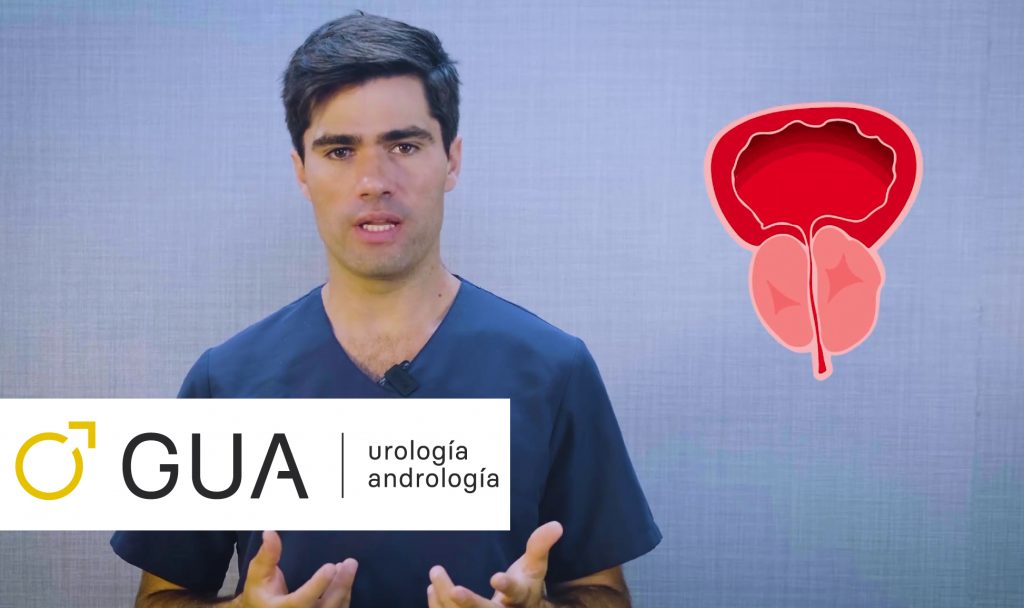 Prostatitis. ¿Qué es y cómo tratarla? - Gabinete de Urología y Andrología